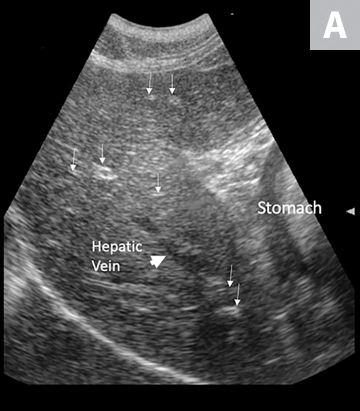 Hepatobiliary Imaging with Radiography & Ultrasonography: Liver ...