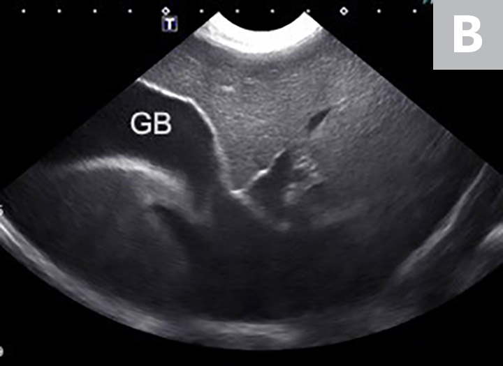 Hepatobiliary Imaging with Radiography & Ultrasonography: Liver ...
