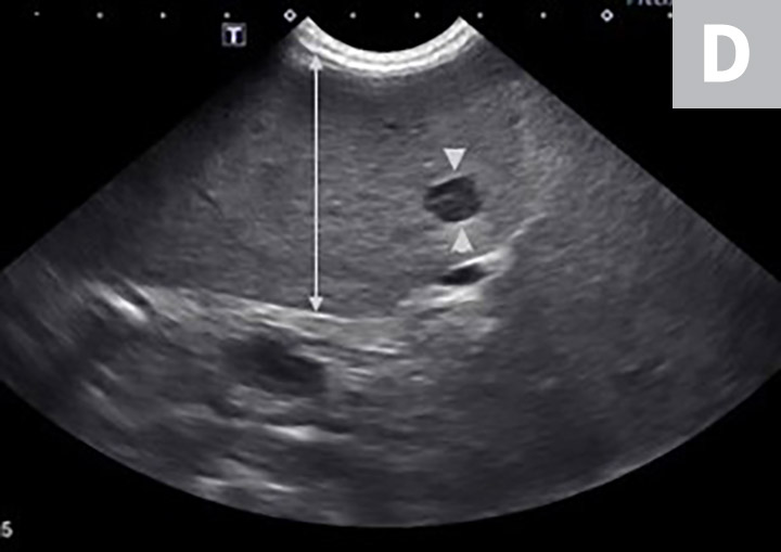 Hepatobiliary Imaging with Radiography & Ultrasonography: Liver ...