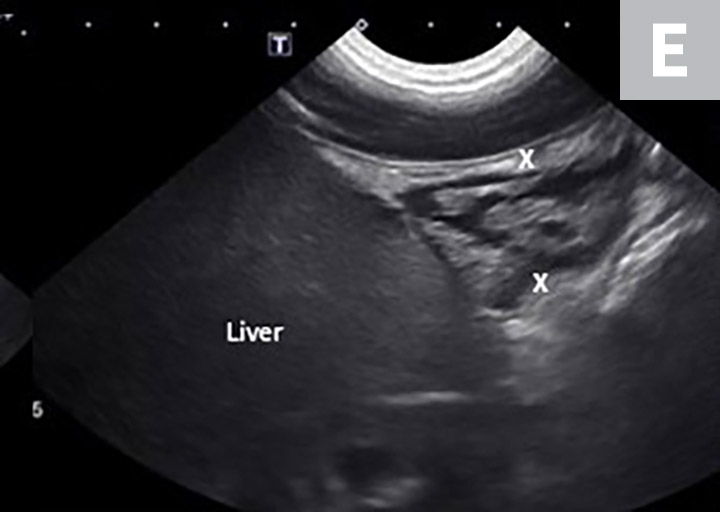 Hepatobiliary Imaging with Radiography & Ultrasonography: Liver ...