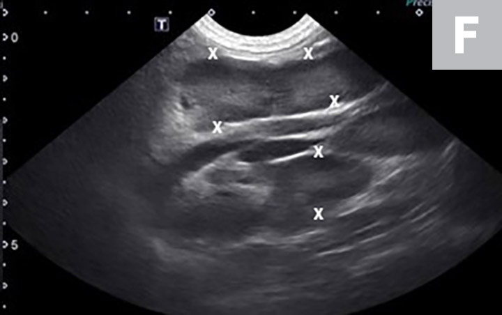 Hepatobiliary Imaging with Radiography & Ultrasonography: Liver ...