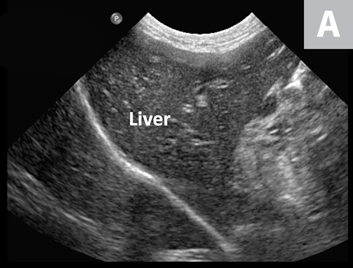 Hepatobiliary Imaging with Radiography & Ultrasonography: Liver ...