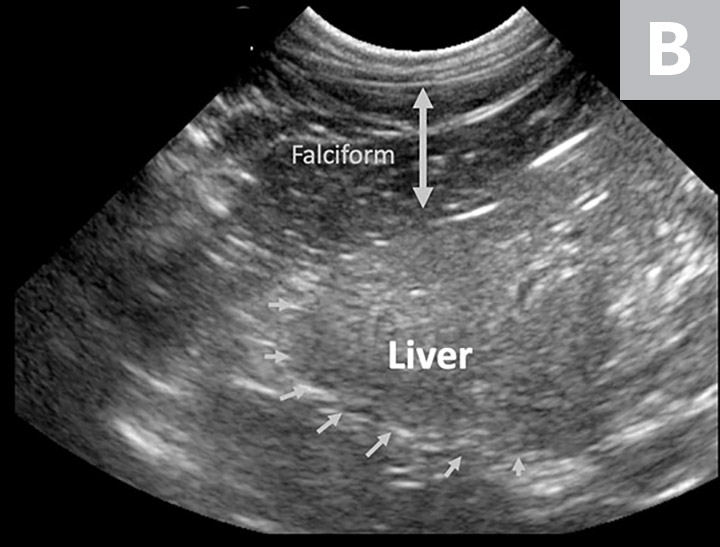 Hepatobiliary Imaging with Radiography & Ultrasonography: Liver ...