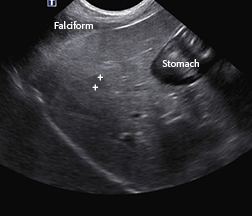 Hepatobiliary Imaging with Radiography & Ultrasonography: Liver ...