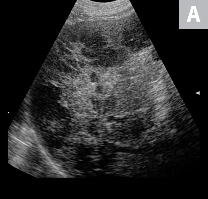 Hepatobiliary Imaging with Radiography & Ultrasonography: Liver ...