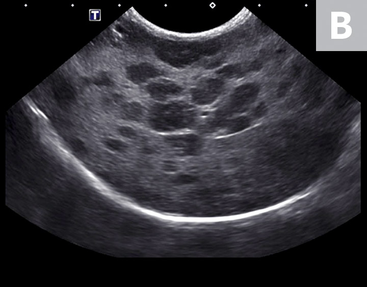 Hepatobiliary Imaging with Radiography & Ultrasonography: Liver ...
