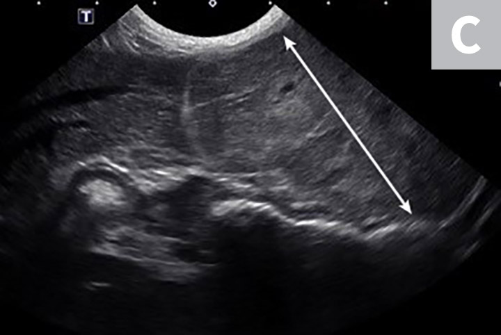 Hepatobiliary Imaging with Radiography & Ultrasonography: Liver ...