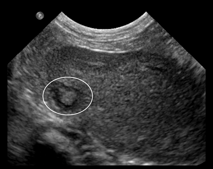 Hepatobiliary Imaging with Radiography & Ultrasonography: Liver ...