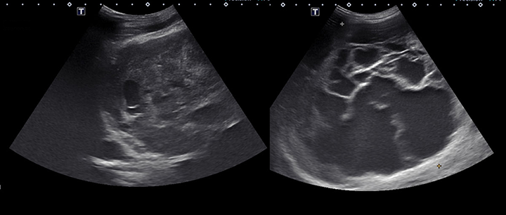 Hepatobiliary Imaging with Radiography & Ultrasonography: Liver ...