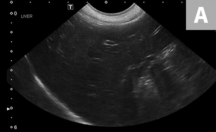 Hepatobiliary Imaging with Radiography & Ultrasonography: Liver ...