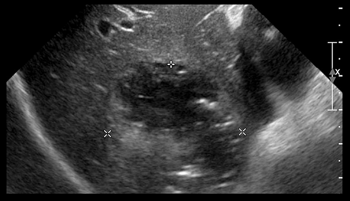 Hepatobiliary Imaging with Radiography & Ultrasonography: Liver ...