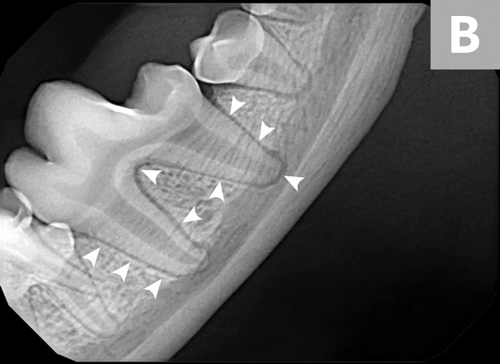 Interpreting Dental Radiographs | Clinician's Brief