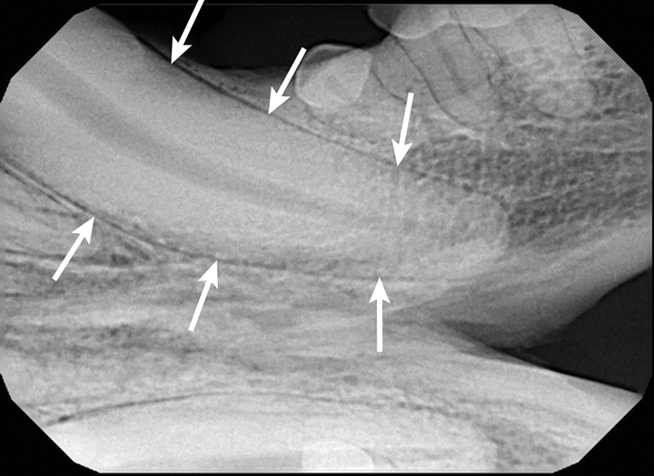 Interpreting Dental Radiographs | Clinician's Brief