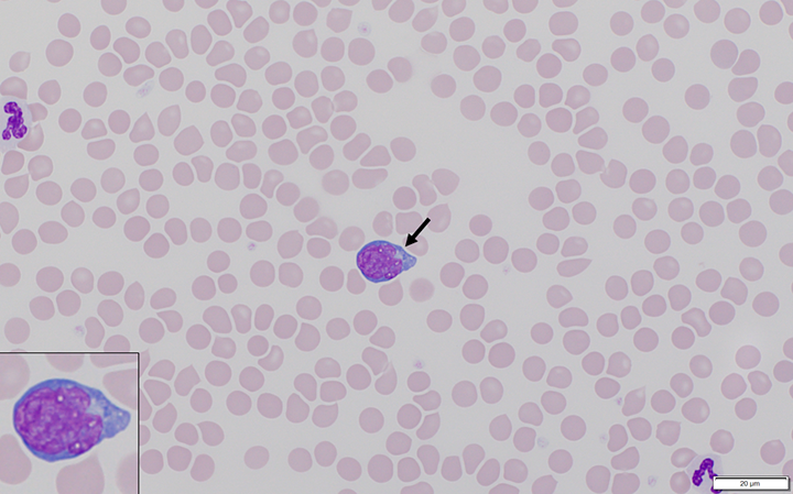 Top 5 Leukogram Patterns Associated with Abnormal Neutrophil ...