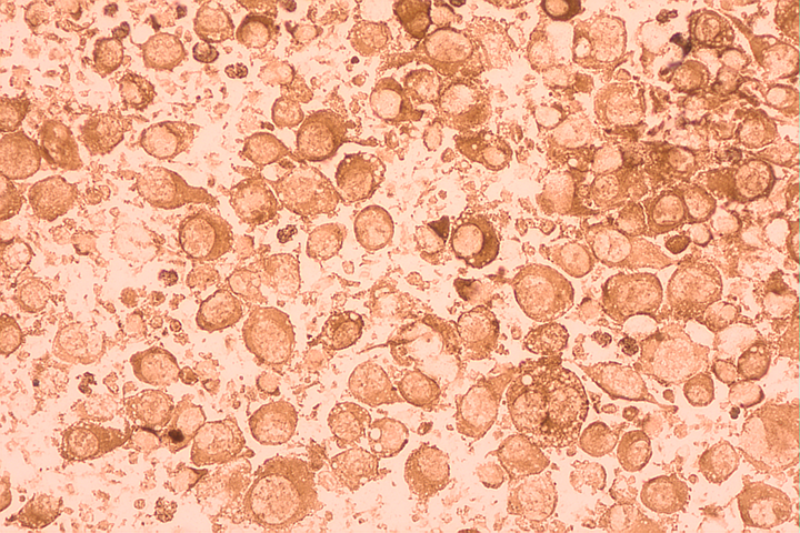 Histiocytic Sarcoma Imaging in Dogs | Clinician's Brief