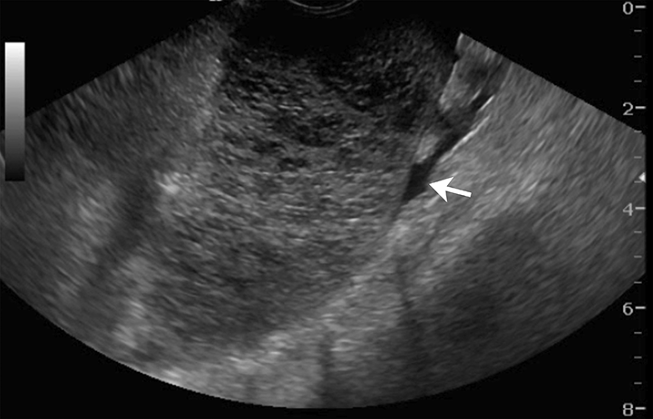 Histiocytic Sarcoma Imaging in Dogs | Clinician's Brief