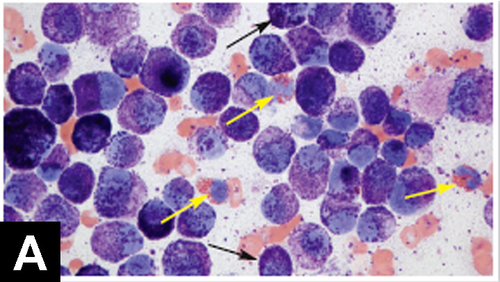Top 5 Masses Diagnosed with In-House Cytology | Clinician's Brief