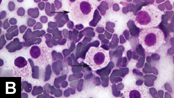 Top 5 Masses Diagnosed with In-House Cytology | Clinician's Brief