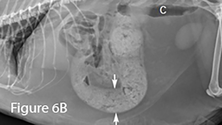 Imaging Intestinal Obstruction | Clinician's Brief