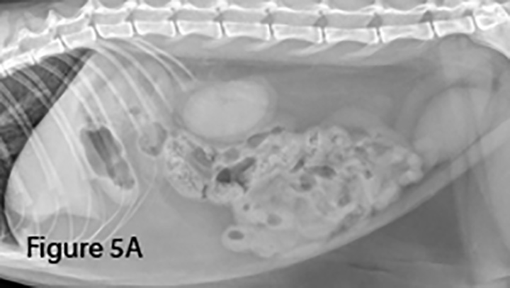 Imaging Intestinal Obstruction | Clinician's Brief
