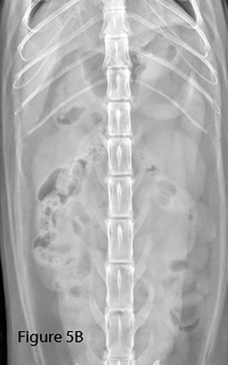 Imaging Intestinal Obstruction | Clinician's Brief