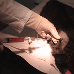 Thoracocentesis | Clinician's Brief