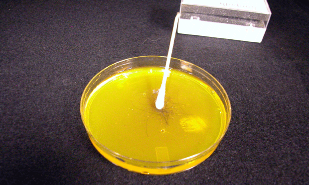 Fungal Cultures for Diagnosing Dermatophytosis | Clinician's Brief