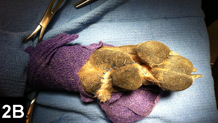 Phalangeal Fillet Technique for Digital Pad Transfer | Clinician's Brief