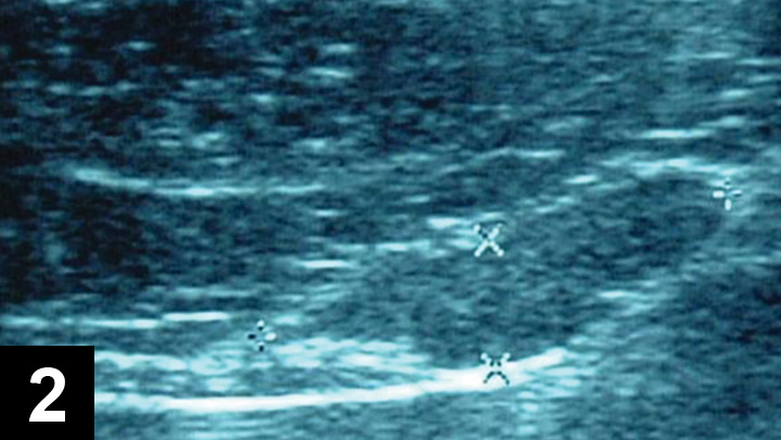 Polyuria & Polydipsia in a Dog with a Perianal Mass | Clinician's Brief