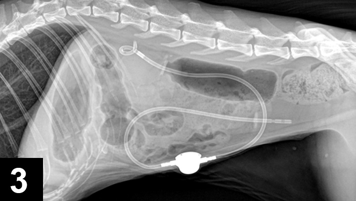 Endourology: A New Way of Looking at Things | Clinician's Brief