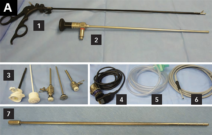 Open & Laparoscopic Liver Biopsy | Clinician's Brief