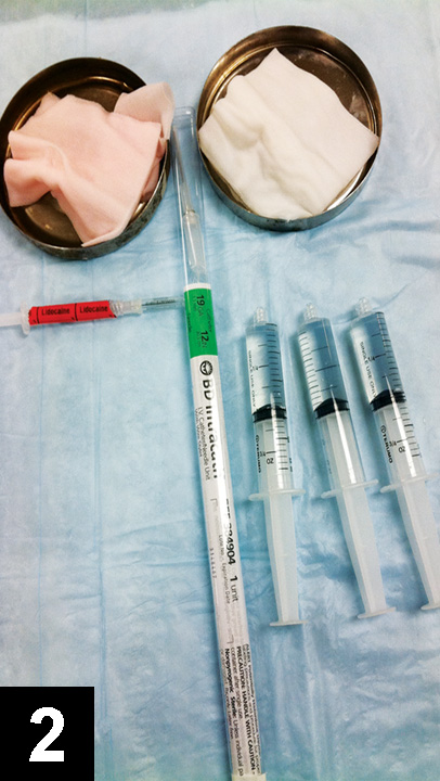 Transoral Tracheal & Transtracheal Airway Wash | Clinician's Brief