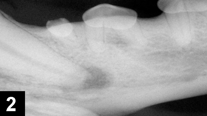 Top 5 Oral & Dental Lesions | Clinician's Brief