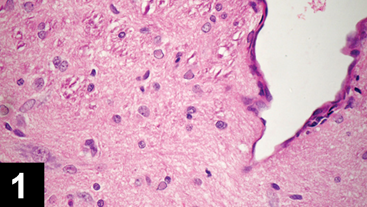 Canine Distemper Virus | Clinician's Brief