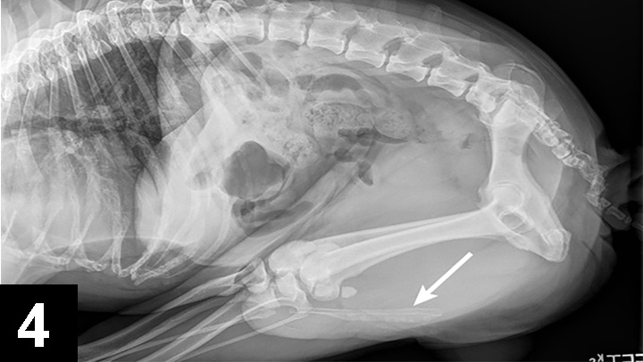 Cystine Urolithiasis | Clinician's Brief