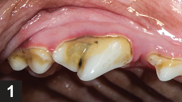 Top 5 Guiding Points for Teeth Scaling | Clinician's Brief