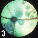 Cryptococcosis in the Cat | Clinician's Brief