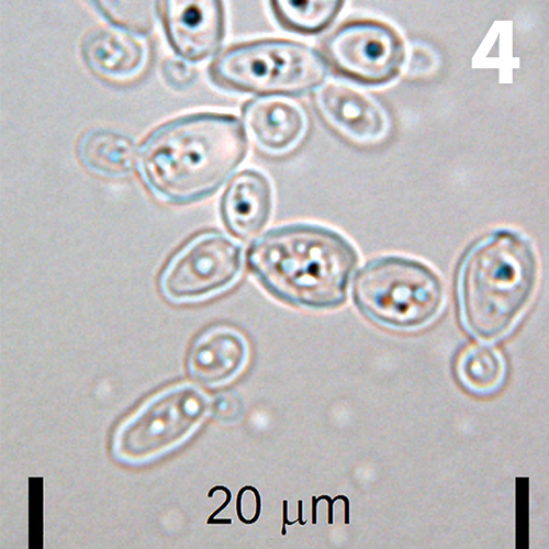Cytology Challenge: Unusual Sediment Findings | Clinician's Brief