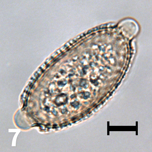 Cytology Challenge: Unusual Sediment Findings | Clinician's Brief