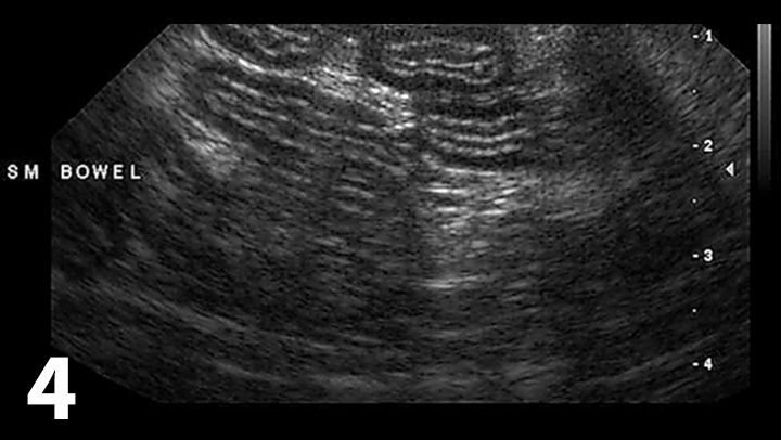 Triaditis Syndrome | Clinician's Brief