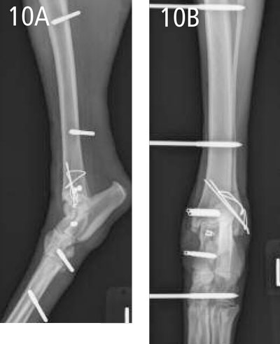 Suture Anchors: A Practical Approach to Stabilizing Joints | Clinician ...