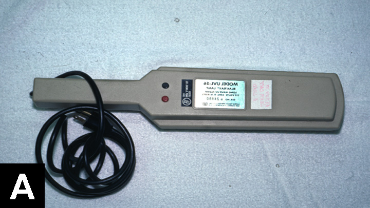 Using a Wood’s Lamp | Clinician's Brief