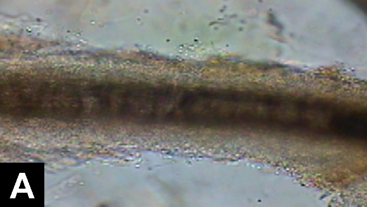 Using a Wood’s Lamp | Clinician's Brief