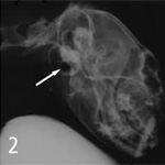 Bulla Radiography | Clinician's Brief