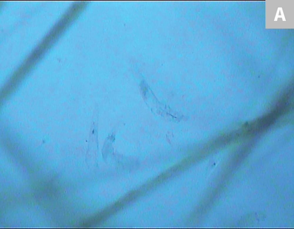 Trichograms | Clinician's Brief