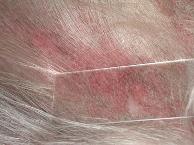 Acute Onset of Skin Lesions in a Dog | Clinician's Brief