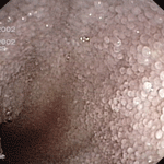 Gastrointestinal Endoscopy in Dogs | Clinician's Brief