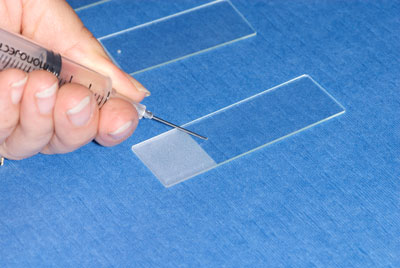 Fine-Needle Aspiration | Clinician's Brief