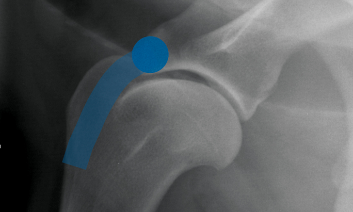 Radiographic Interpretation of the Canine Shoulder | Clinician's Brief