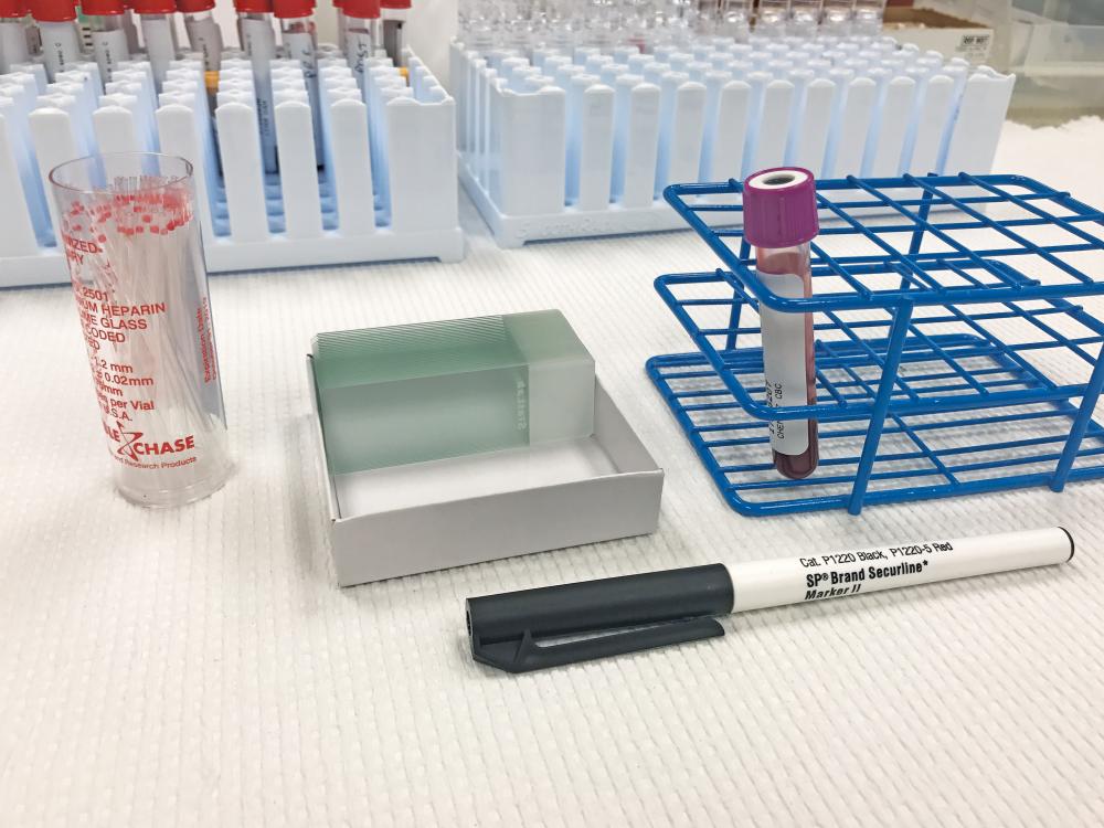 Blood Smear Preparation | Clinician's Brief
